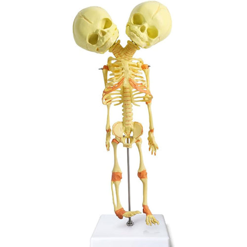 Evotech Scientific Human Infant Skeleton Model, Twin-Skull, Human Fetu