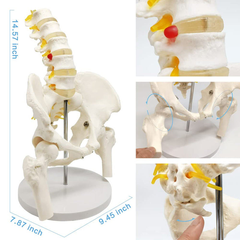 Evotech Scientific Life Size Male Pelvis Model with 5 Lumbar Spine, W/