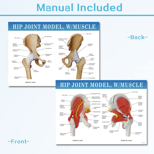 Evotech Scientific Hip Joint Model W/Removable Muscles, 6 Parts Life S