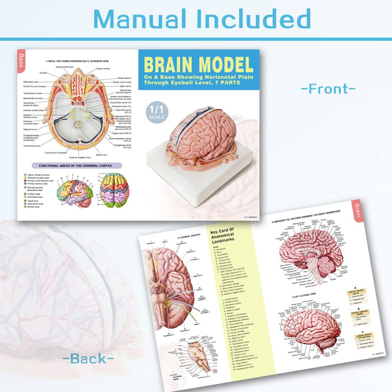 Evotech Deluxe Brain Model on Cranial Plain, W/ Dura Mater & Arteries,